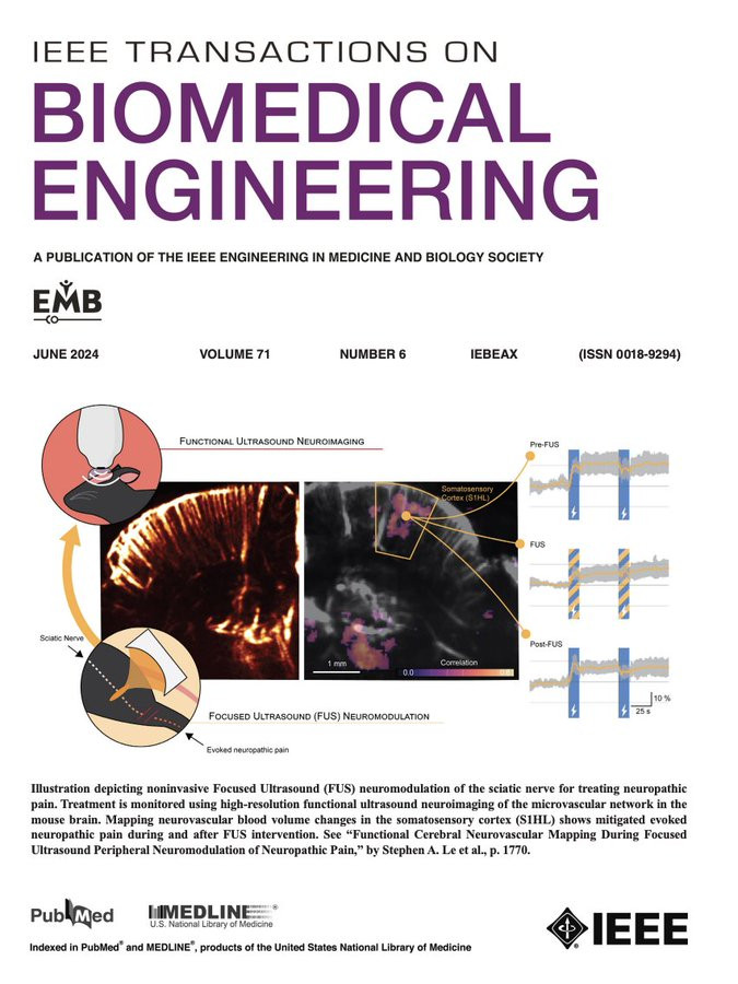 Stephen Lee's Article Featured on IEEE TBME Cover